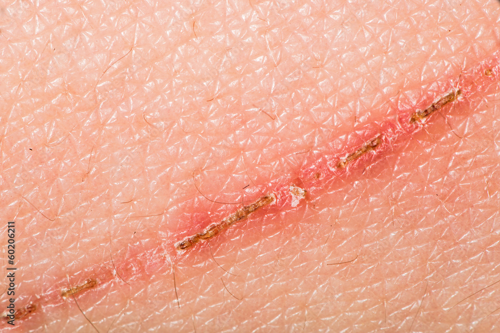 Texture of human skin and scratch Stock Photo | Adobe Stock