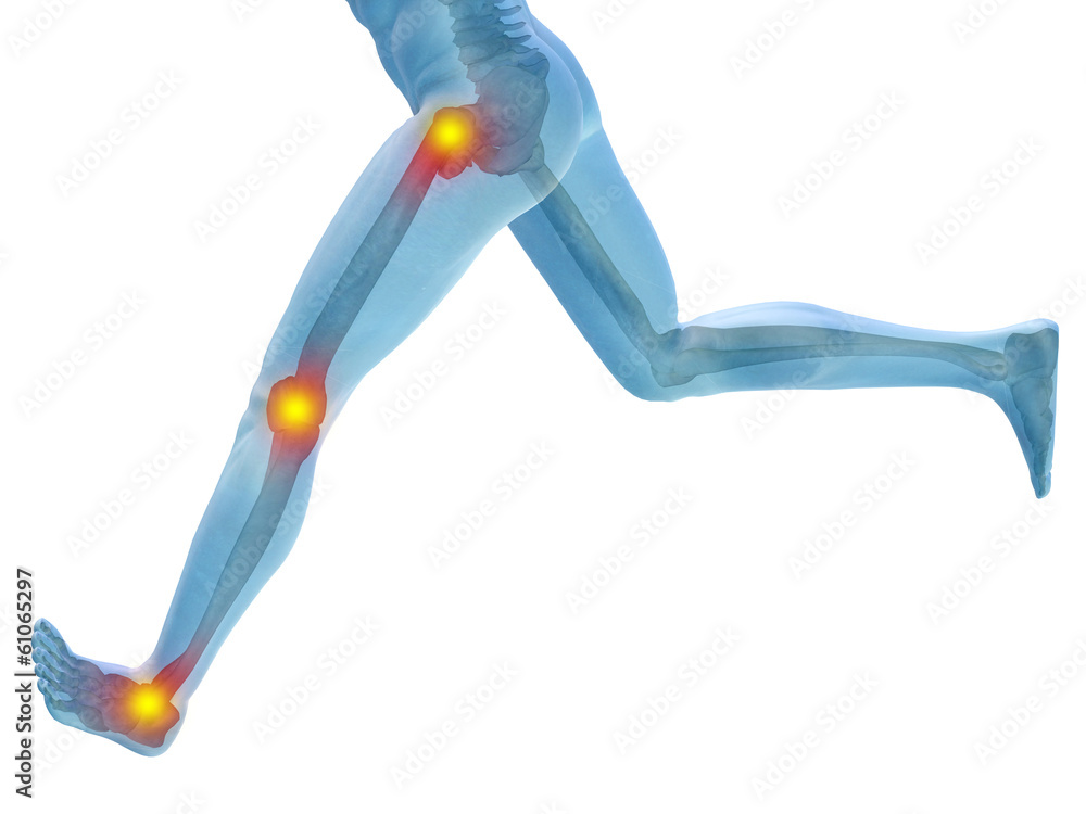 Conceptual human pain anatomy Stock Illustration | Adobe Stock