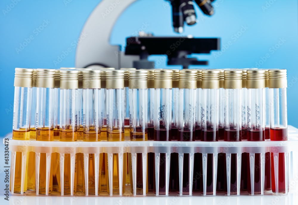 microscope and tubes with liquid medium in laboratory Stock Photo ...