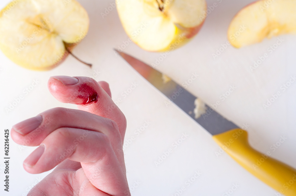 Finger cut Stock Photo | Adobe Stock