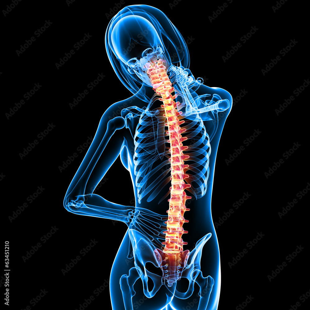 Female back pain anatomy Stock Illustration | Adobe Stock