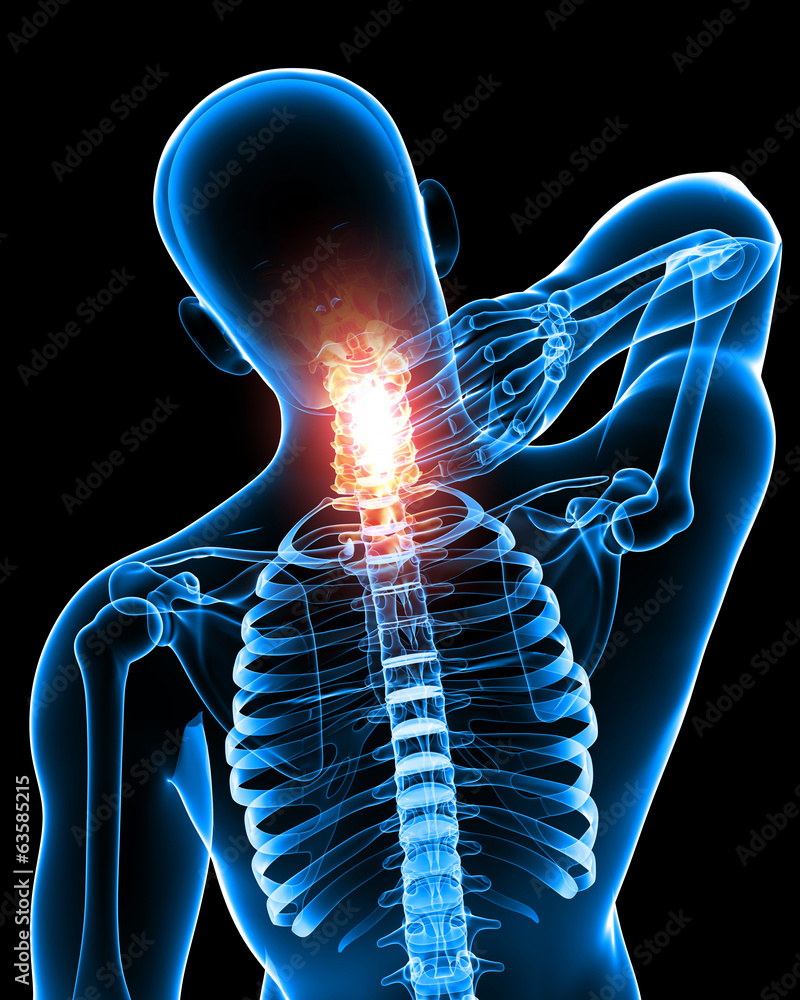 Anatomy of male neck pain blue Stock-Illustration | Adobe Stock