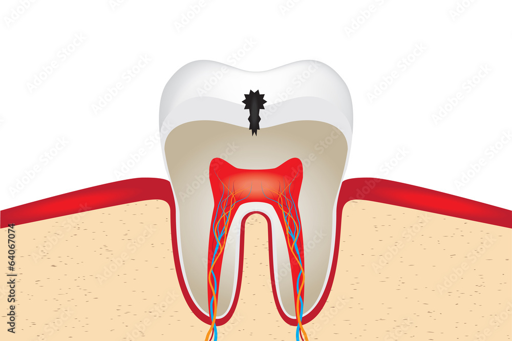 Crop of tooth Stock Vector | Adobe Stock