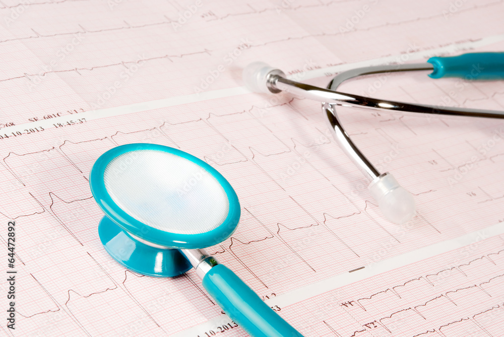 Stethoscope on an electrocardiogram (ECG) chart Stock Photo | Adobe Stock