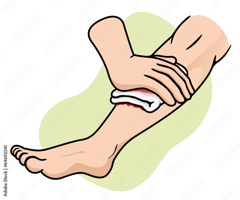 Aid First stop bleeding in leg Stock Vector | Adobe Stock