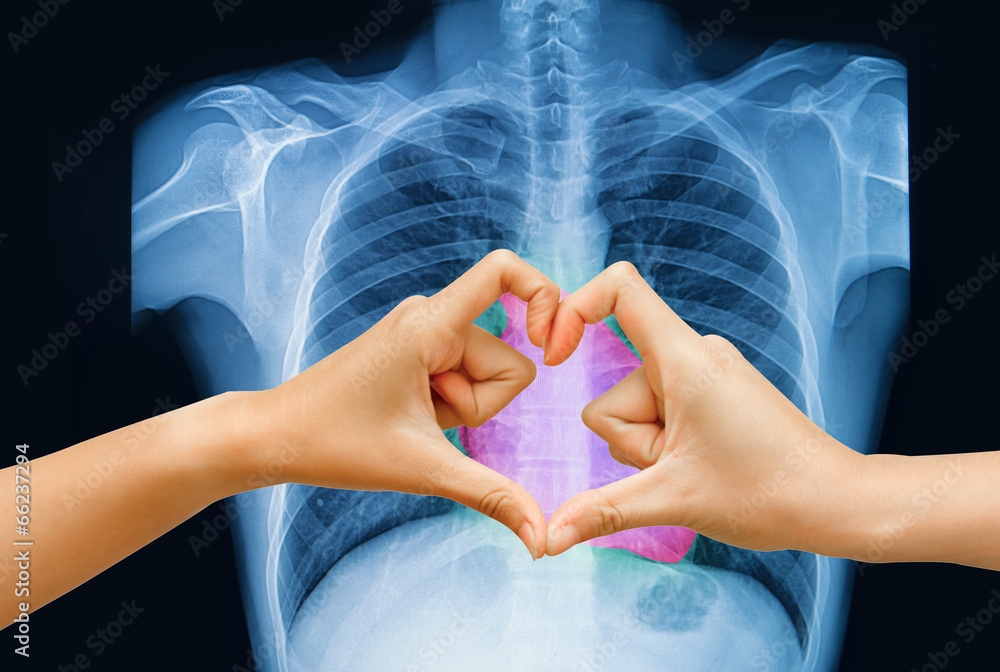 Hand make a heart shape on chest x-ray image Stock Photo | Adobe Stock