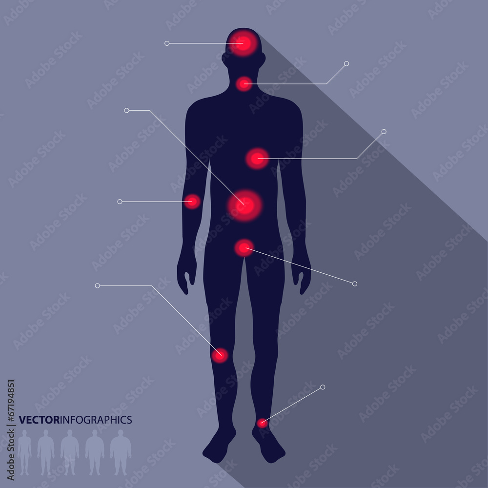 Man silhouette, pain point. Vector medical infographics Stock Vector ...