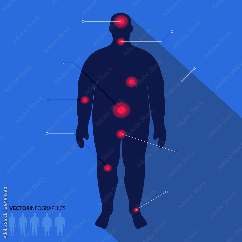Fat man silhouette, pain point. Vector medical infographics Stock ...