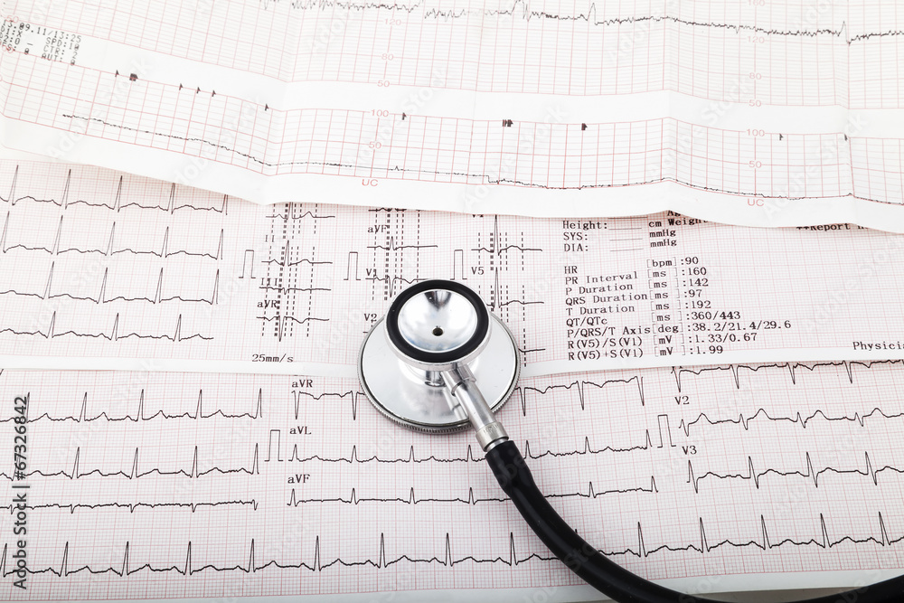 Stethoscope on an electrocardiogram (ECG) chart Stock Photo | Adobe Stock