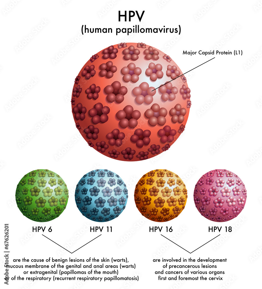 HPV papilloma Virus Umano Vector De Stock Adobe Stock HPV papilloma Virus Umano Vector De Stock Adobe Stock