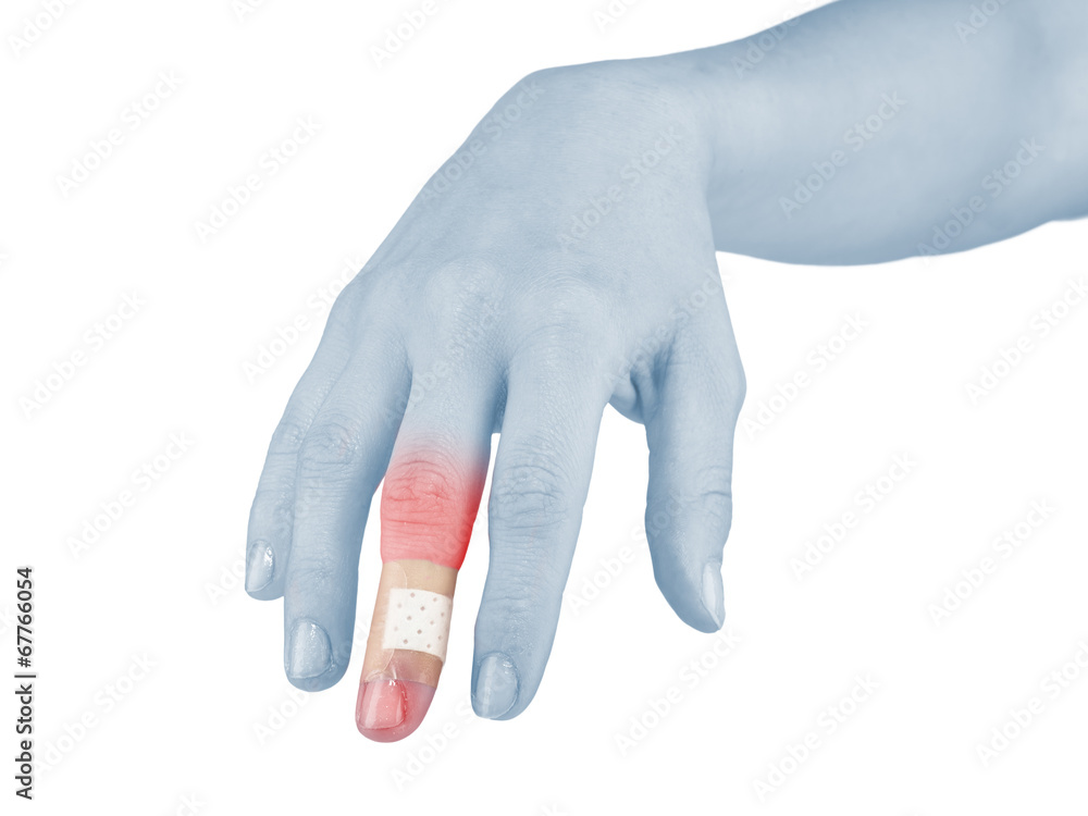 Adhesive Healing plaster on finger. Stock-Foto | Adobe Stock