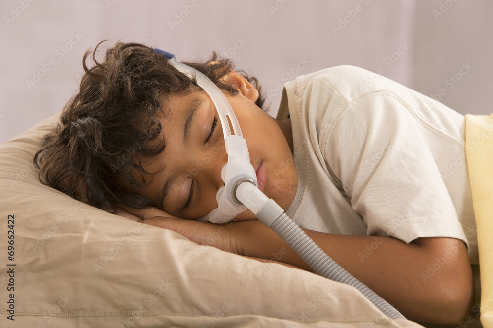 syndrome de l'apnee du someil chez l'enfant -traitement par pres ...
