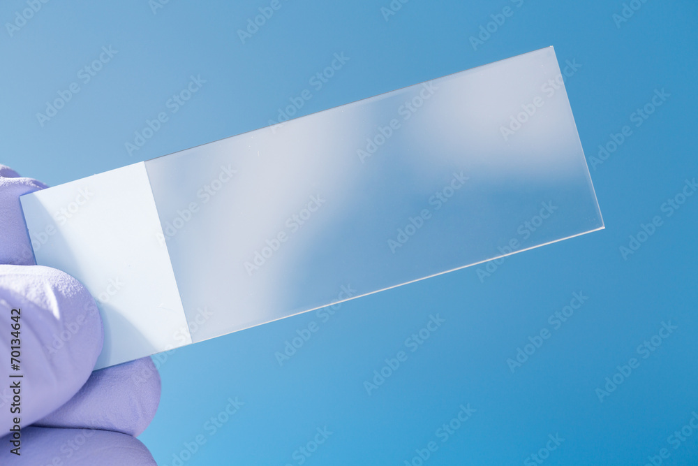 Microscopy slide in hand Stock Photo | Adobe Stock