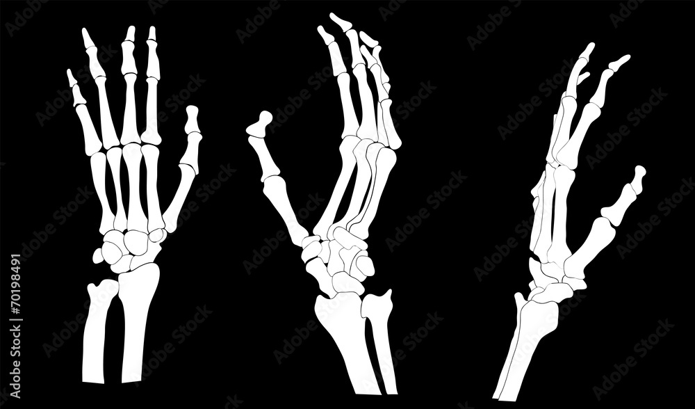 SKELETON HANDS Stock Vector | Adobe Stock