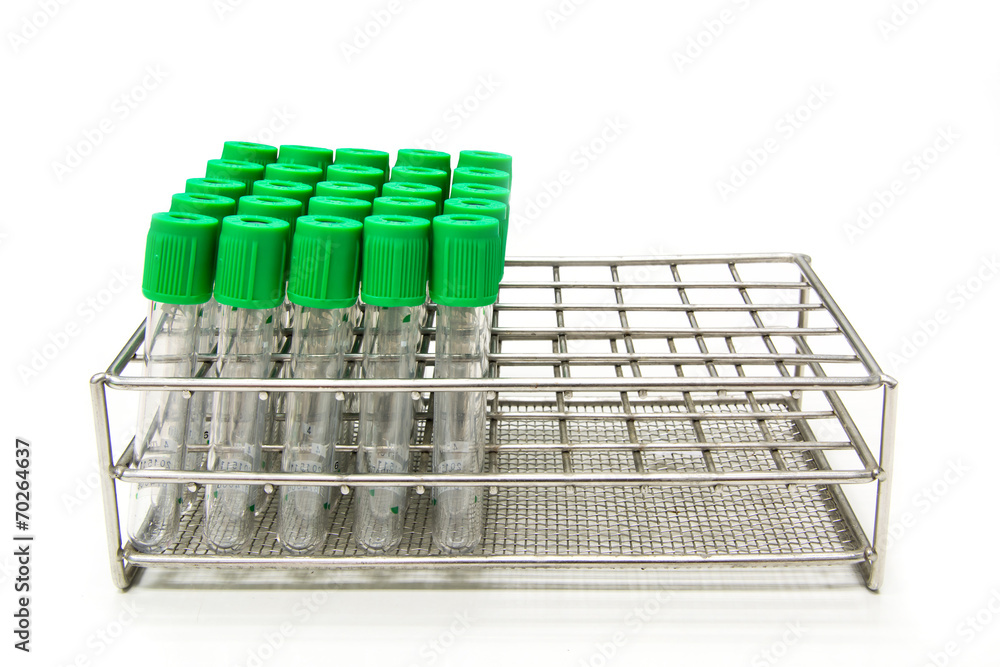 medical blood tube, test tube in rack for laboratory Stock-Foto | Adobe ...