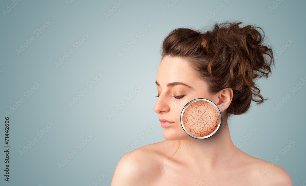 Beautiful young girl with magnifying glass of skin damage Stock Photo ...
