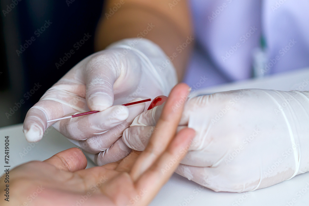 Blood test Stock Photo | Adobe Stock