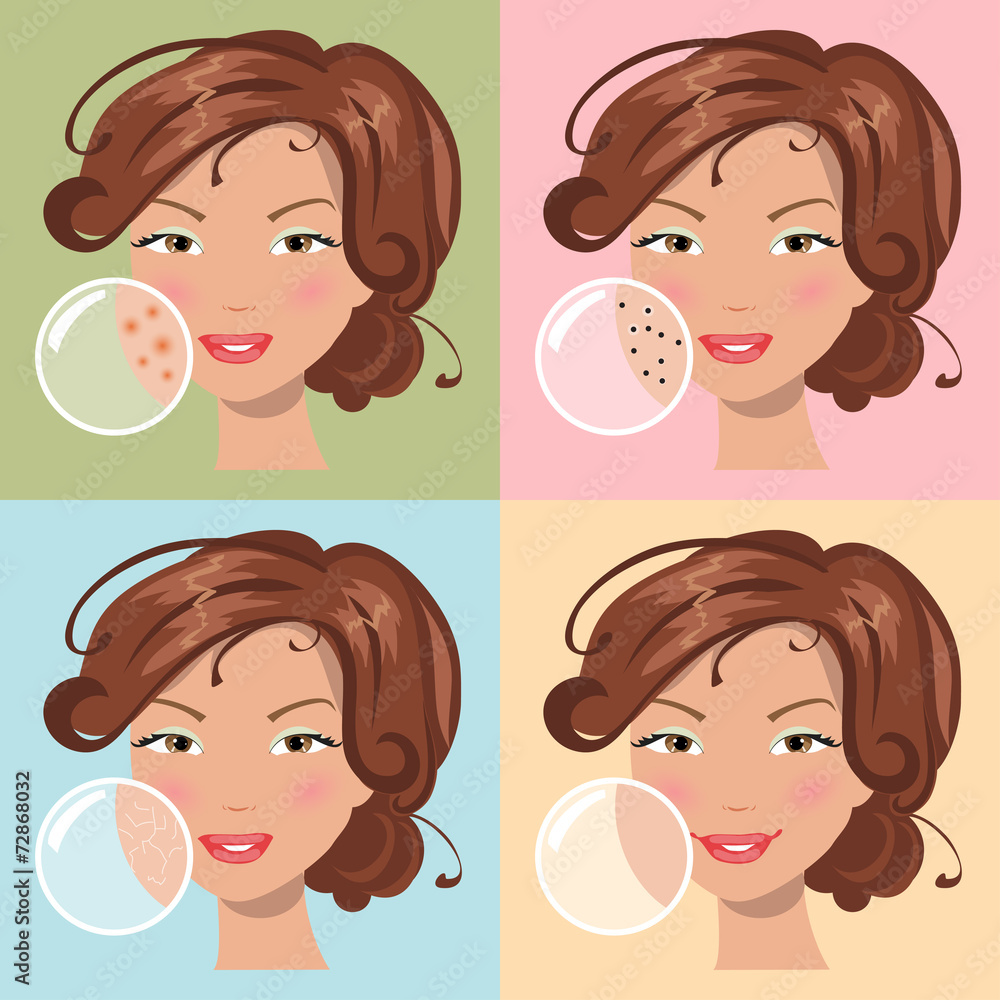 Different skin problems. Vector illustration Stock Vector | Adobe Stock