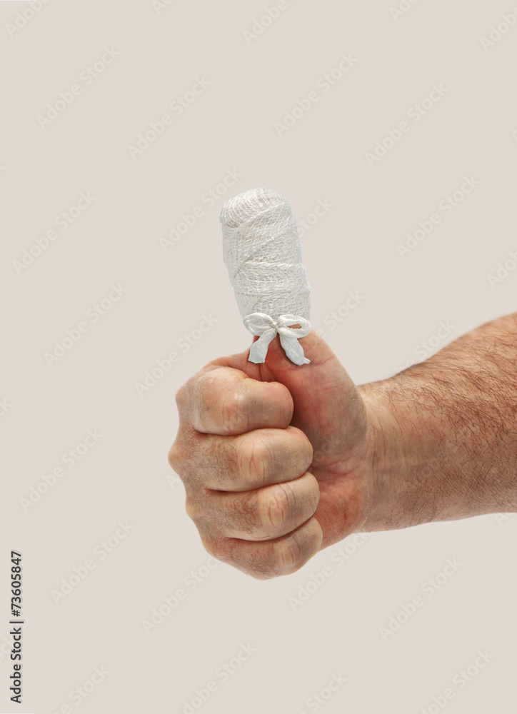 Daumenverband Stock-Foto | Adobe Stock