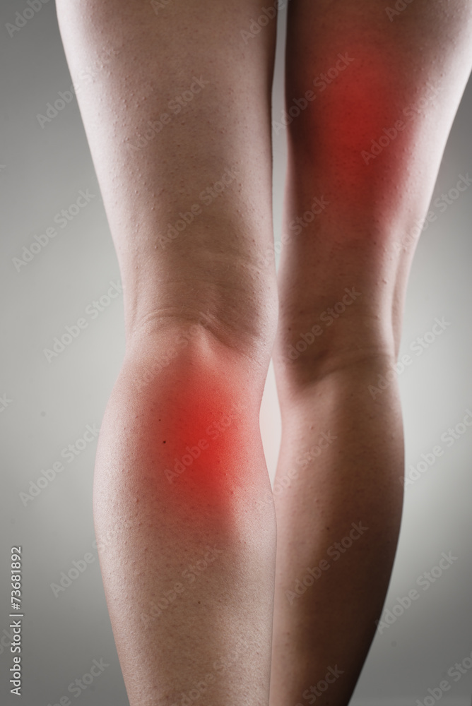 Injured female legs with red spots. Muscle strain and stretch. Stock ...
