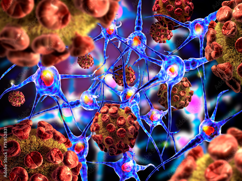 viruses attacking nerve cells, concept for Neurologic Diseases Stock ...
