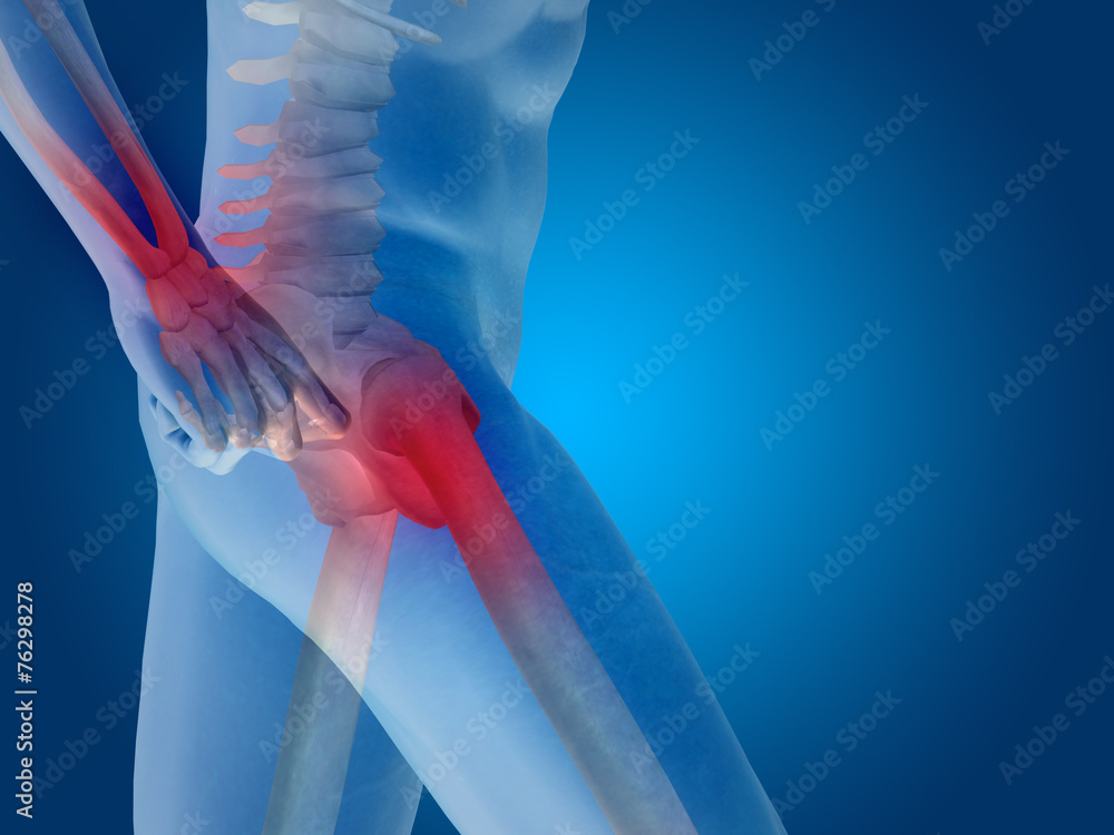 Conceptual human body anatomy pain on blue Stock Illustration | Adobe Stock