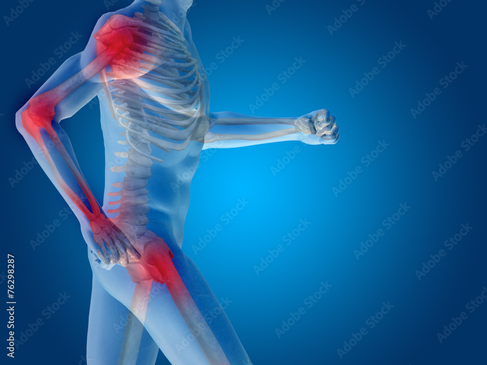 Conceptual human body anatomy pain on blue Stock Illustration | Adobe Stock