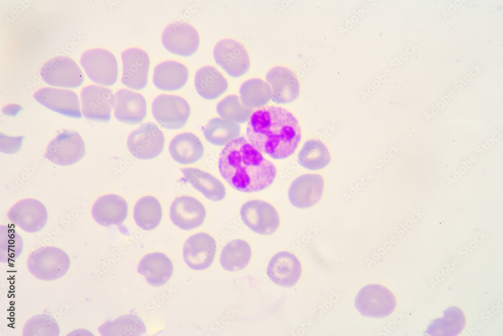 segmented neutrophils Stock Photo | Adobe Stock