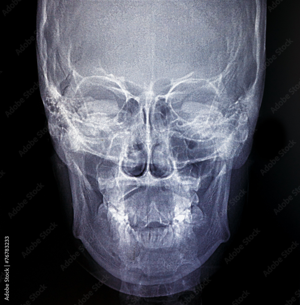 X-Ray scan human Stock Photo | Adobe Stock