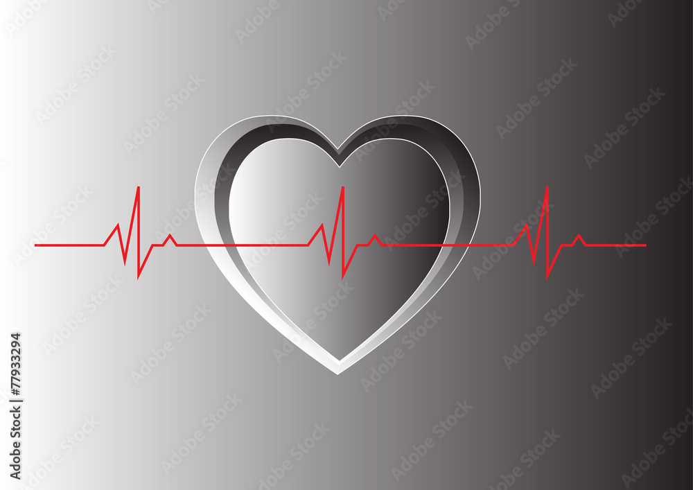 Normal Ekg Clipart