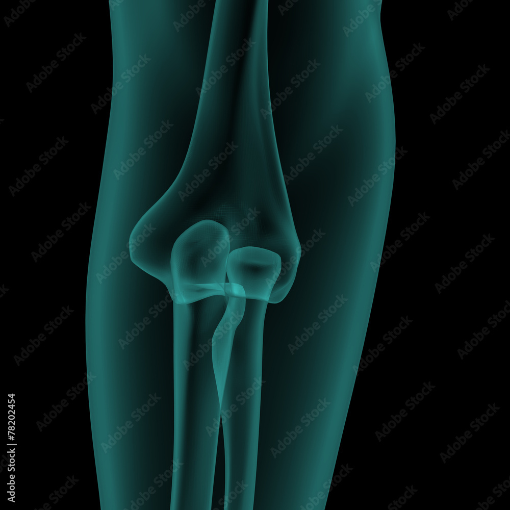front x-ray view of human elbow Stock Illustration | Adobe Stock