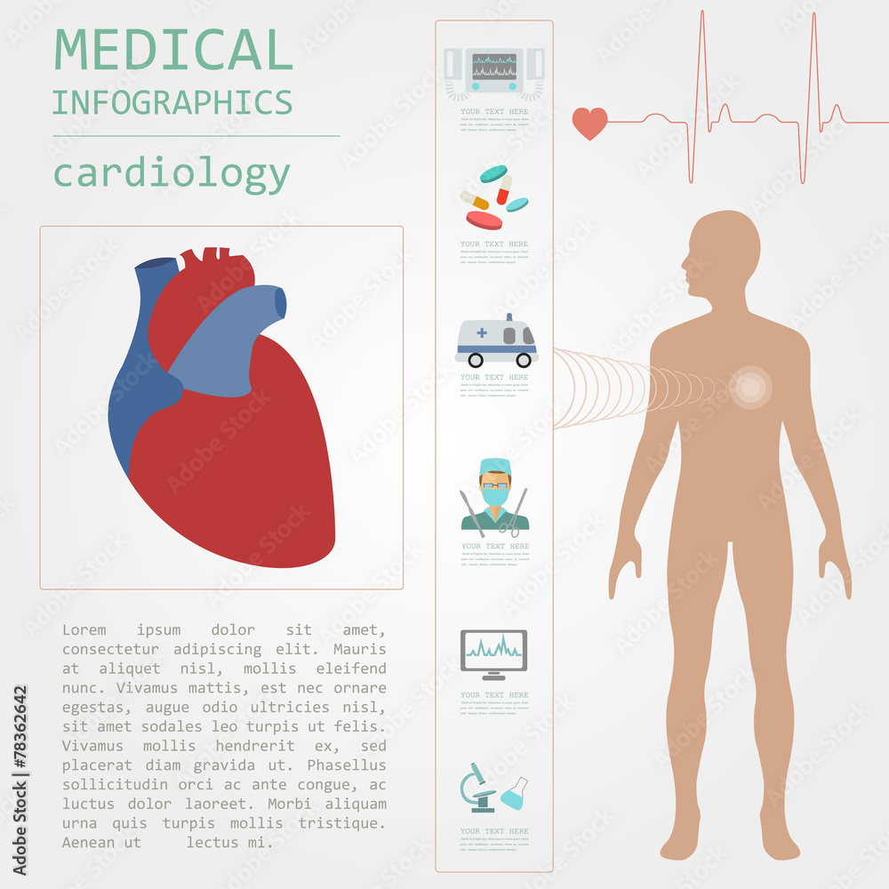 Medical and healthcare infographic, Cardiology infographics. Stock ...