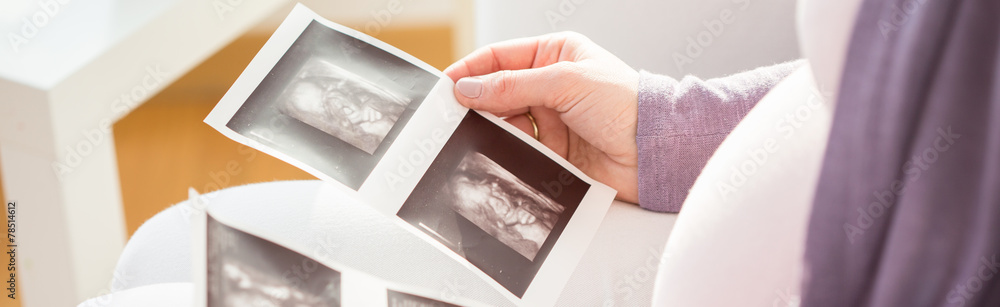 Usg photos Stock Photo | Adobe Stock