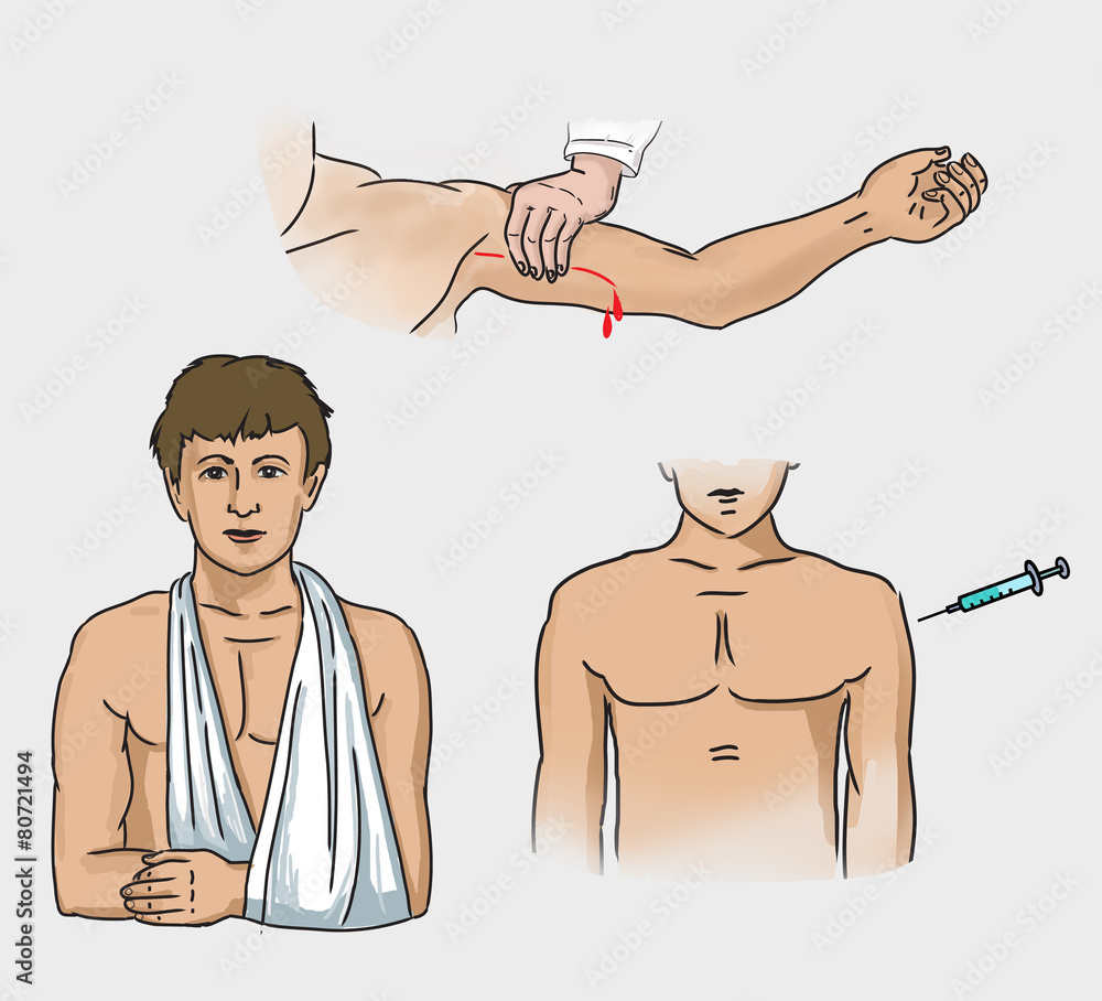 First aid for arterial bleeding hands.First aid. Stock Illustration ...