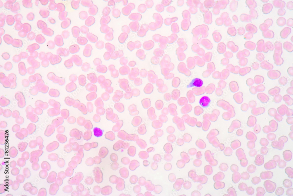 A blood smear is often used as a follow-up test to abnormal resu Stock ...