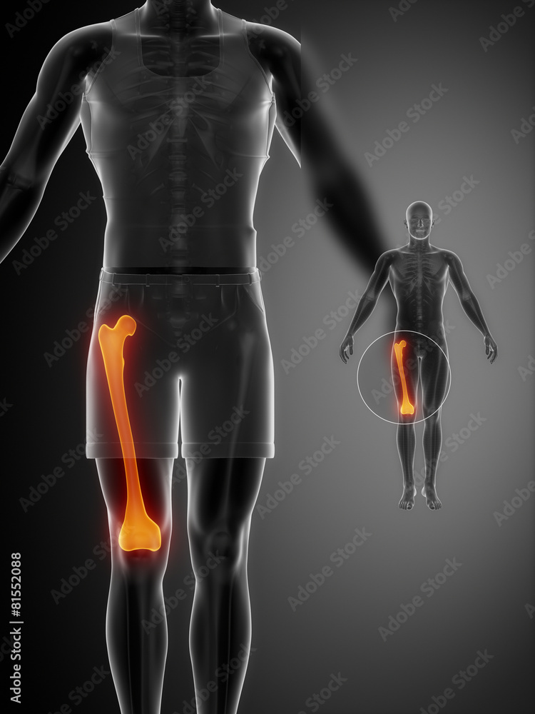 FEMUR black x--ray bone scan Stock Illustration | Adobe Stock