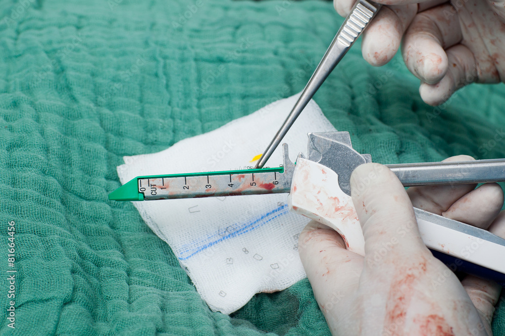 Bauchoperation Stock-Foto | Adobe Stock