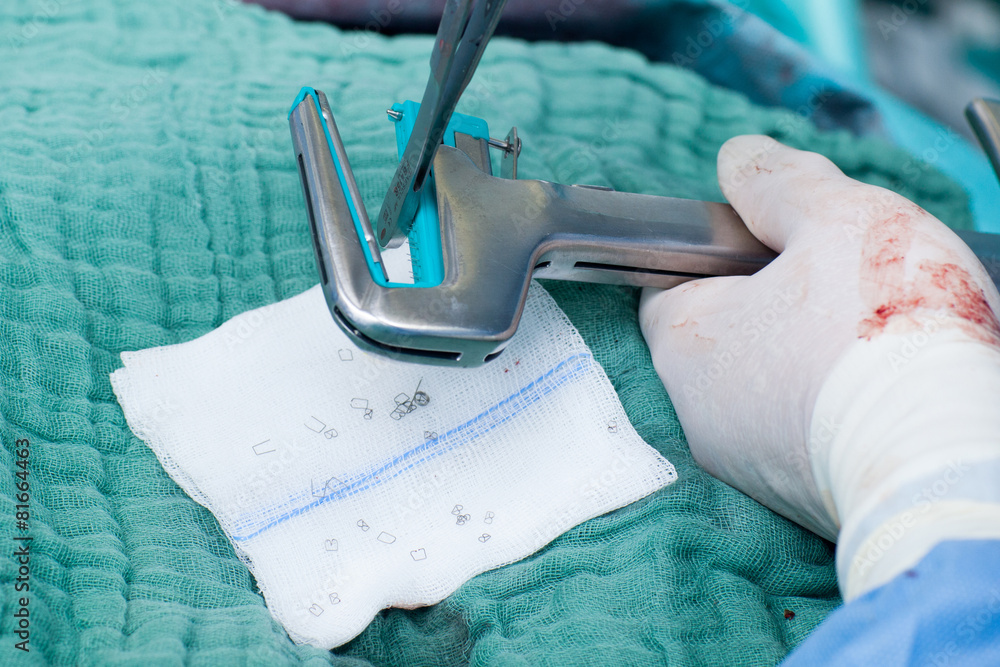 Bauchoperation Stock-Foto | Adobe Stock