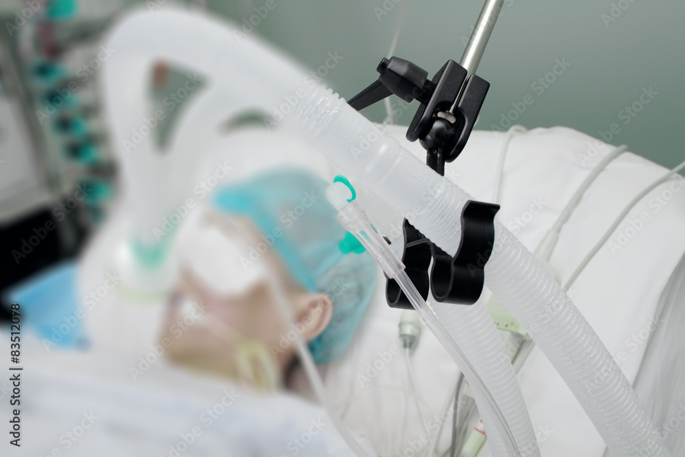Breathing circuit of patient on the ventilator in ICU Stock Photo ...