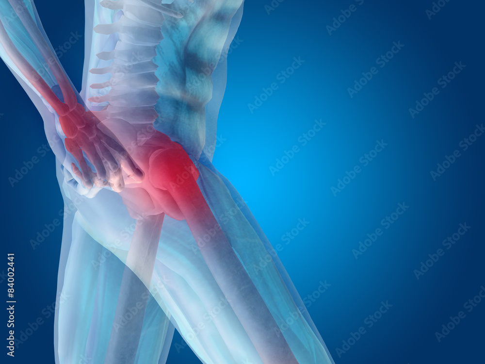 Conceptual human body anatomy pain on blue Stock Illustration | Adobe Stock