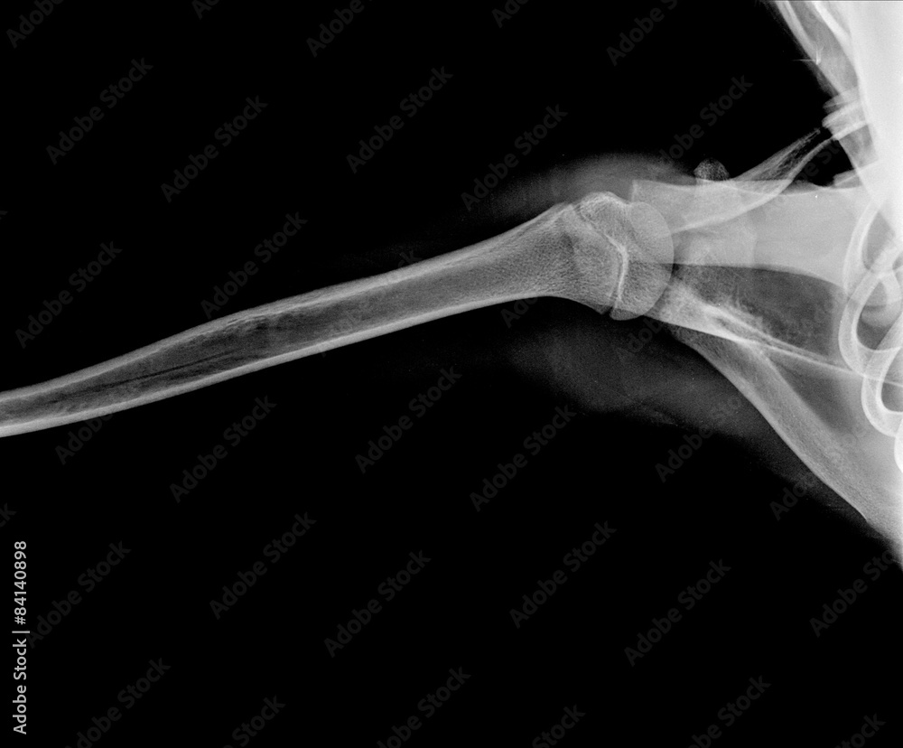 X-ray film of child shoulder fracture. Stock Photo | Adobe Stock