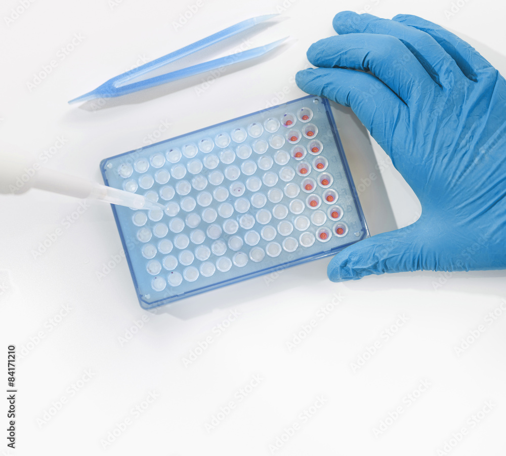 Assembly of PCR reaction for DNA analysis Stock Photo | Adobe Stock