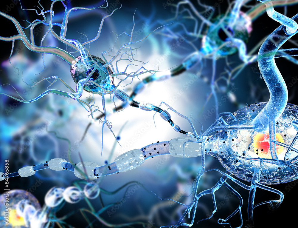 nerve cells, concept for Neurological Diseases and brain surgery. Stock ...