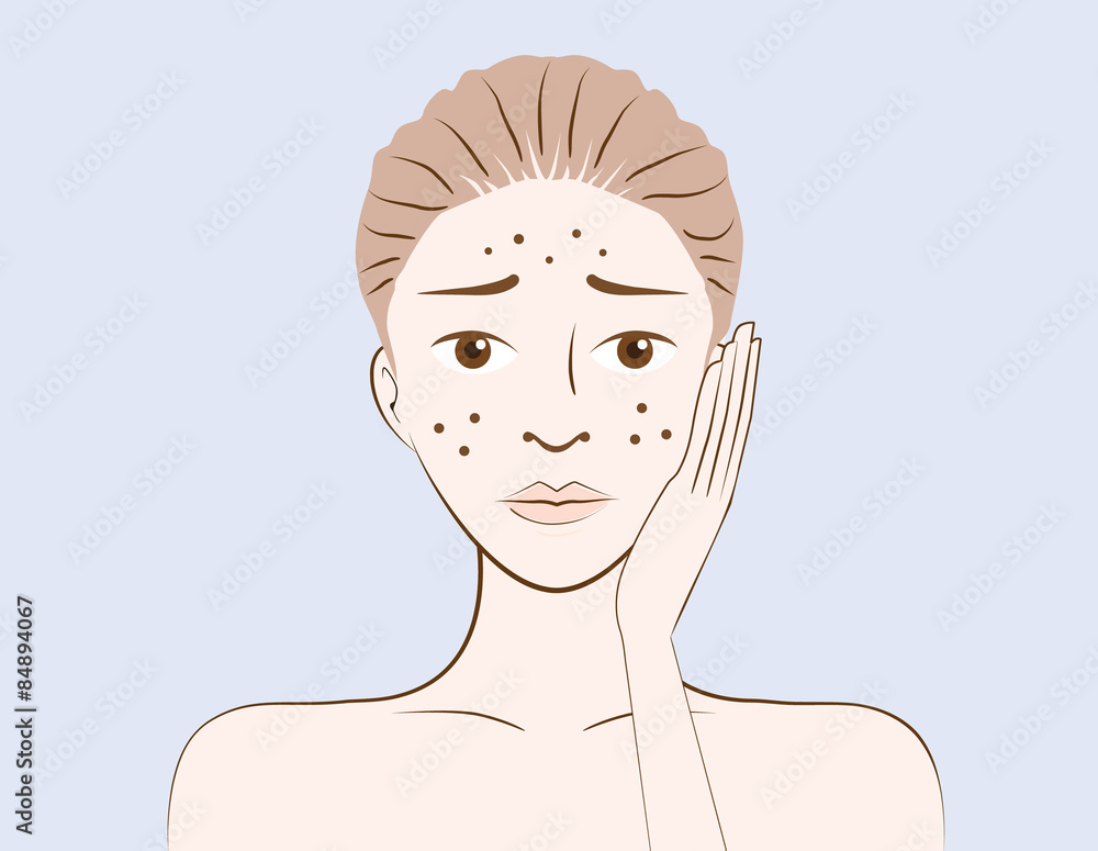 Acne Face Cartoon