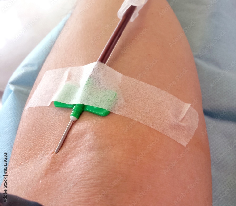 blood donor during the transfusion at the hospital with the needle in ...