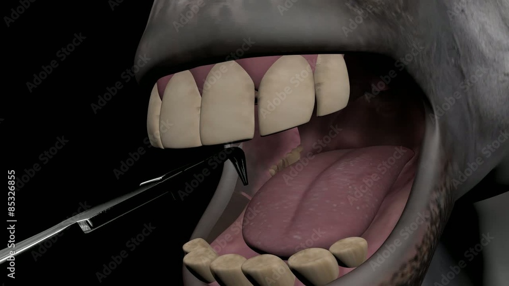 3D medical animation about diseased equine teeth and explaining several ...