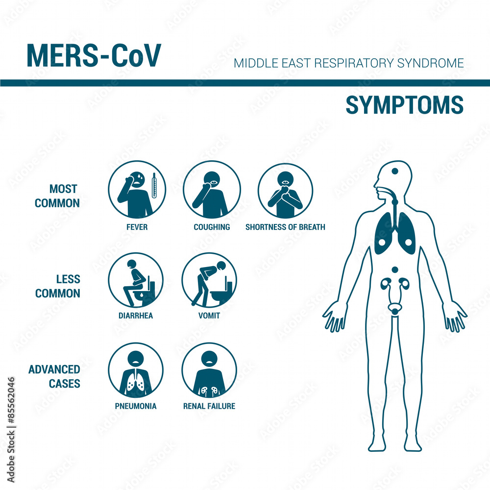 Mers symptoms infographics Stock Vector | Adobe Stock