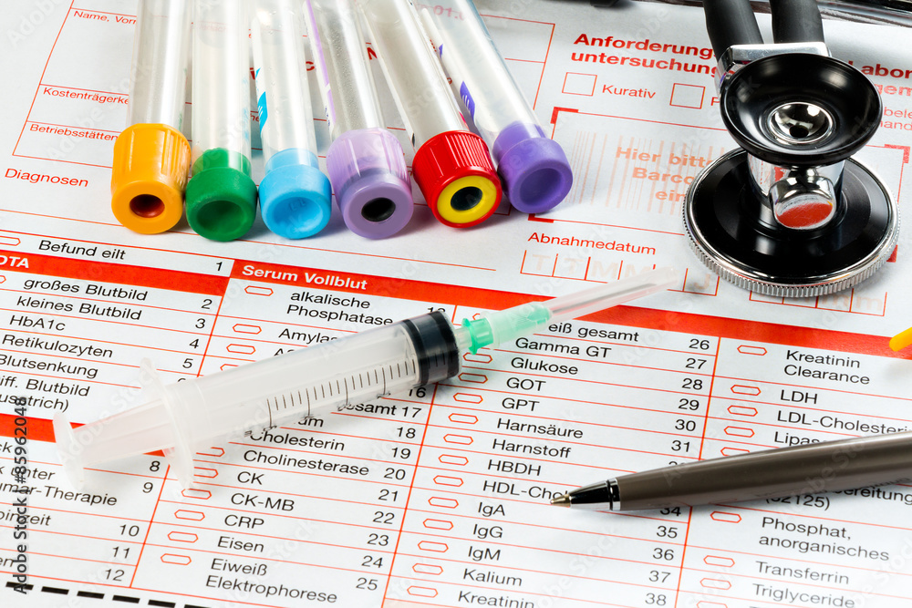Laborzettel und Utensilien für die Blut Untersuchung foto de Stock ...