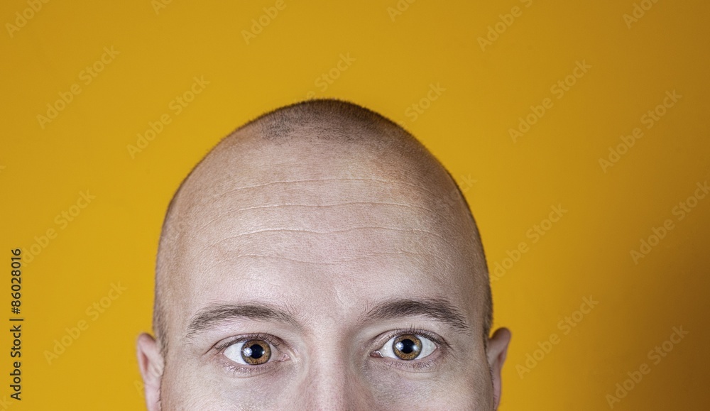 Half head of a bald man Stock Photo | Adobe Stock