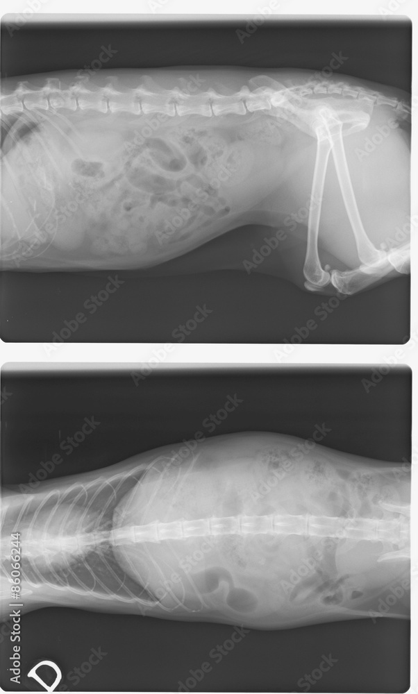 Side and top view of negative X-Ray of spinal column, chest, abdomen ...
